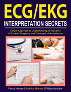مواصفات و سعر ECG EKG INTERPRETATION SECRETS: Simple Approach to ...